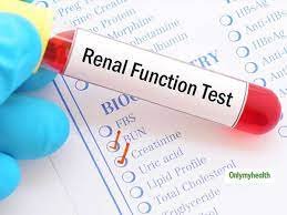 KFT -( Kidney Function Test) – Quickdiagno- Diagnostics & Dental